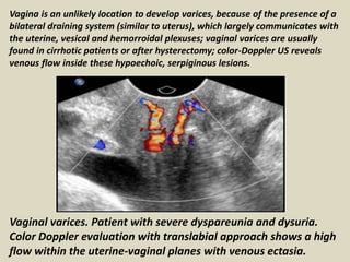 Presentation1.pptx, ultrasound examination of the uterus and ovaries ...
