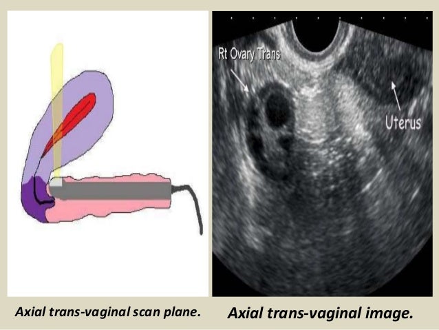 Uterus Anatomy Test