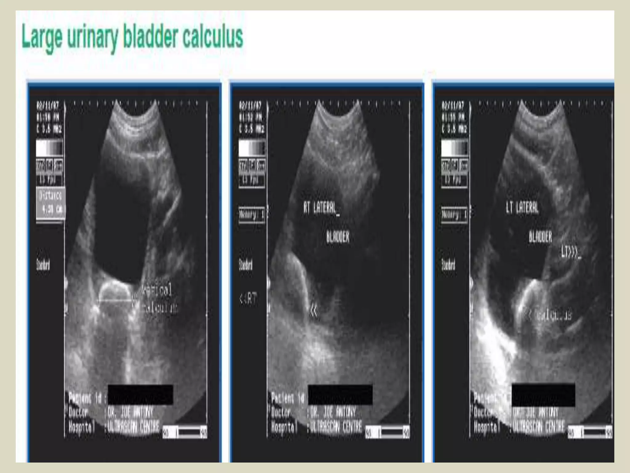 Presentation1.pptx, ultrasound examination of the urinary bladder and ...