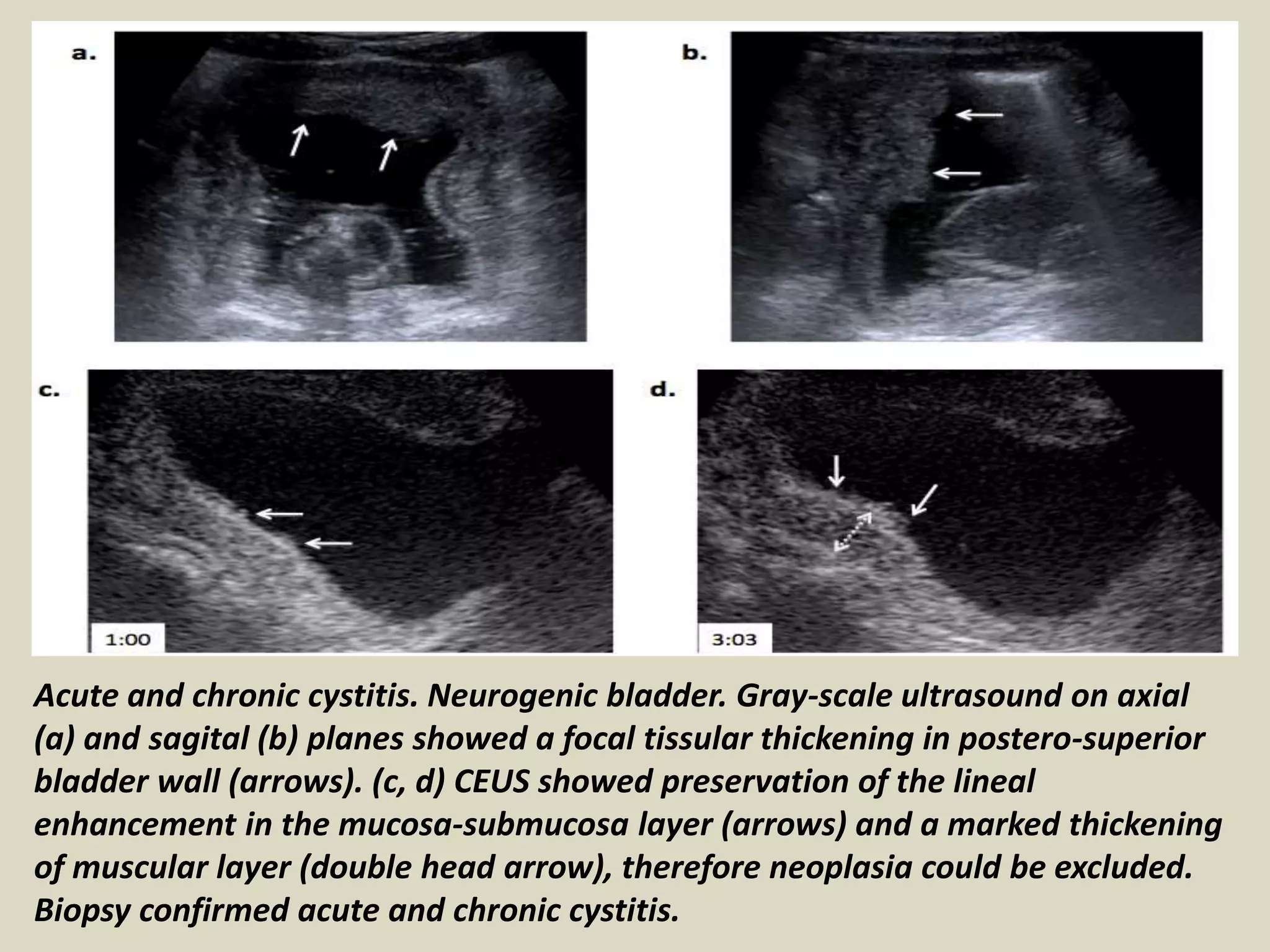Presentation1.pptx, ultrasound examination of the urinary bladder and ...