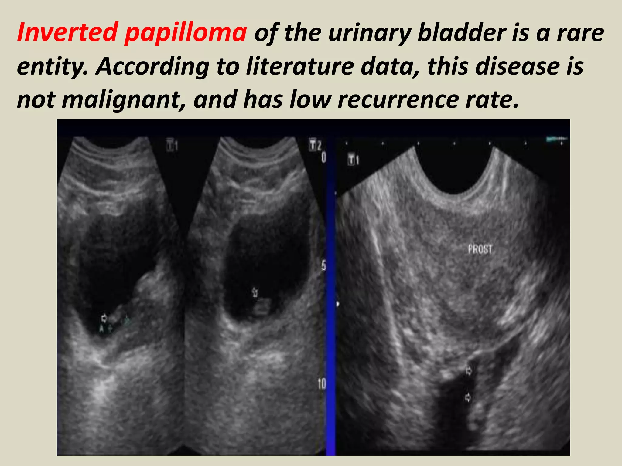 Presentation1.pptx, ultrasound examination of the urinary bladder and ...