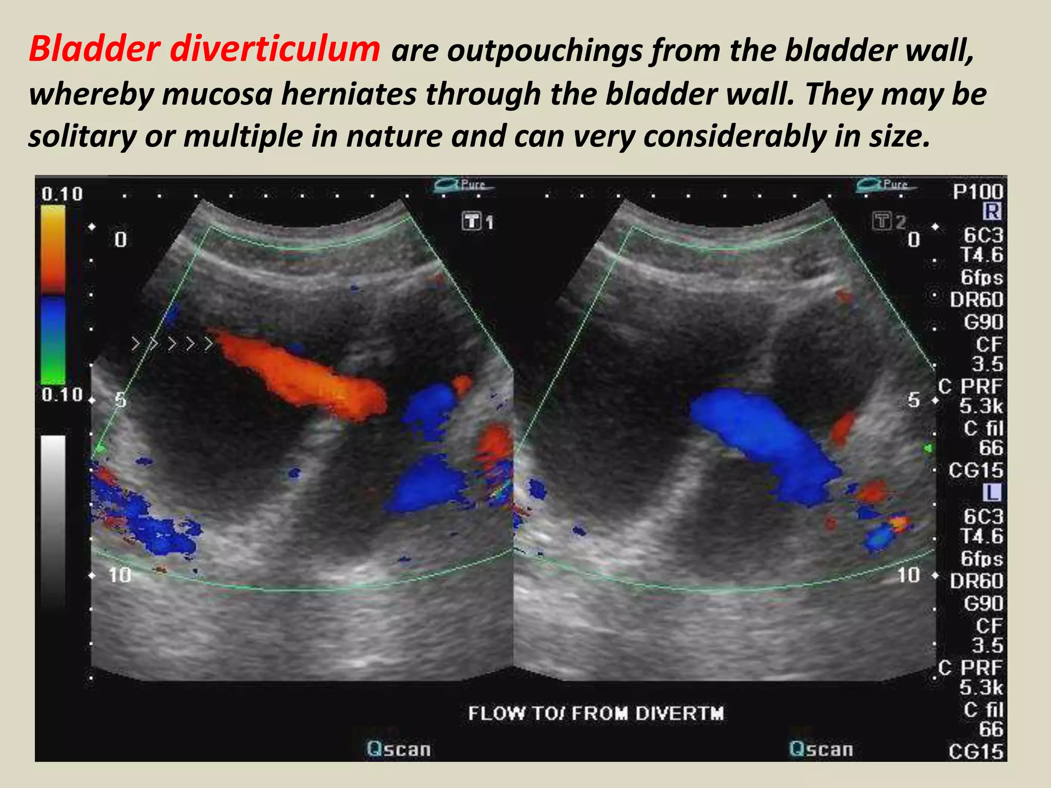 Presentation1.pptx, ultrasound examination of the urinary bladder and ...