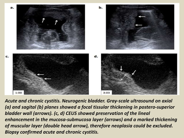 Presentation1.pptx, ultrasound examination of the urinary bladder and ...
