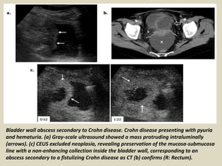 Presentation1.pptx, ultrasound examination of the urinary bladder and ...