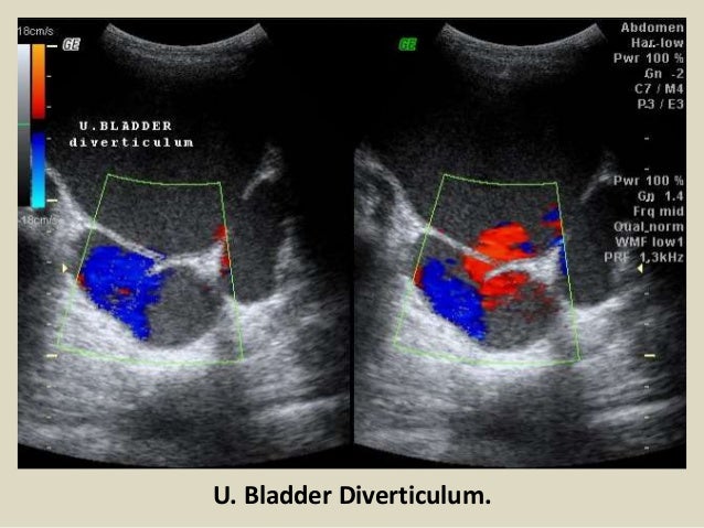 Presentation1.pptx, ultrasound examination of the urinary bladder and…