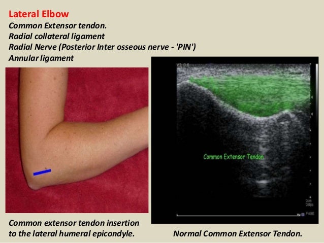 Presentation1.pptx, ultrasound examination of the elbow joint.