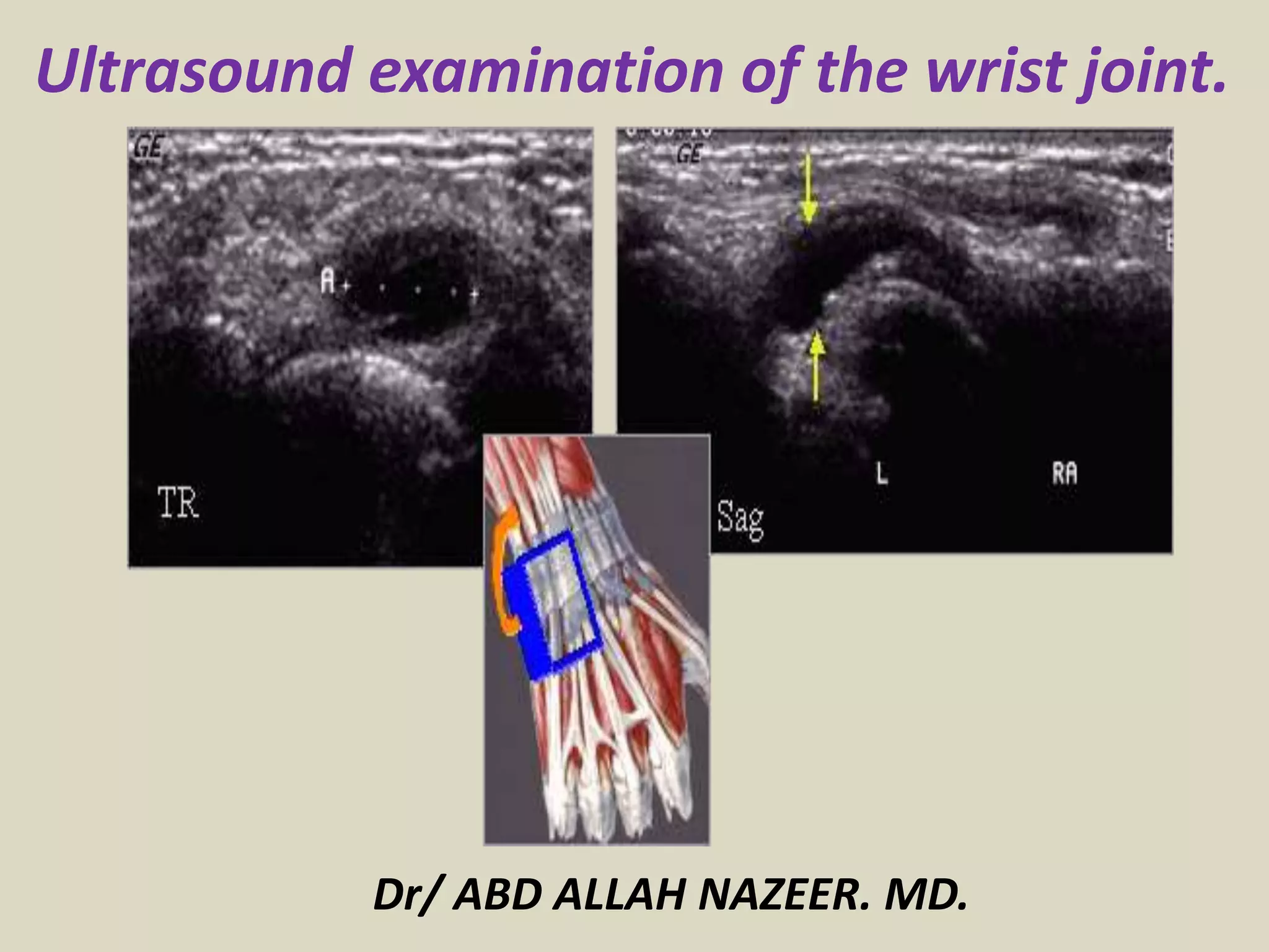 Presentation1.pptx, ultrasound examination of the wrist joint. | PPTX
