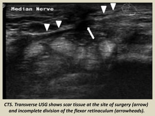 Presentation1.pptx, ultrasound examination of the wrist joint. | PPTX