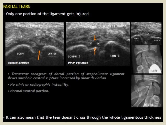 Presentation1.pptx, ultrasound examination of the wrist joint.