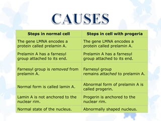 Progeria Syndrome | PPT | Free Download