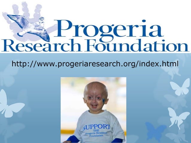 Progeria Syndrome | PPT