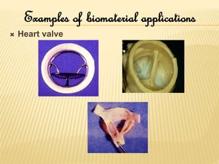 Biomaterials and its applications. | PPTX