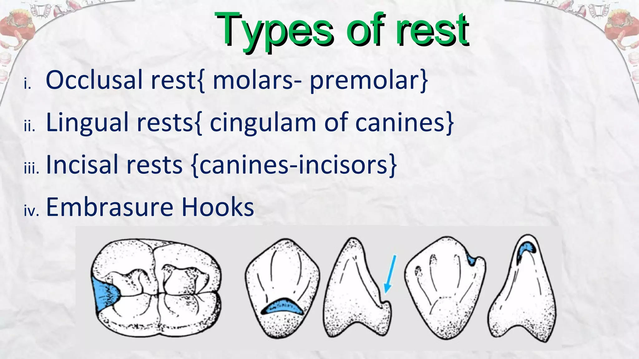 Rest and Rest Seat preparation..removable partial denture | PPT