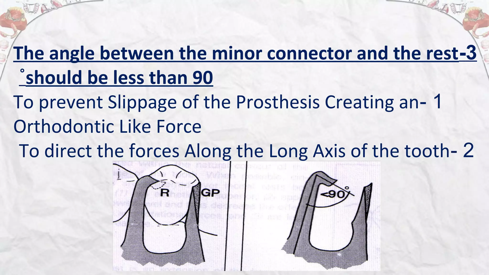 Rest and Rest Seat preparation..removable partial denture | PPT
