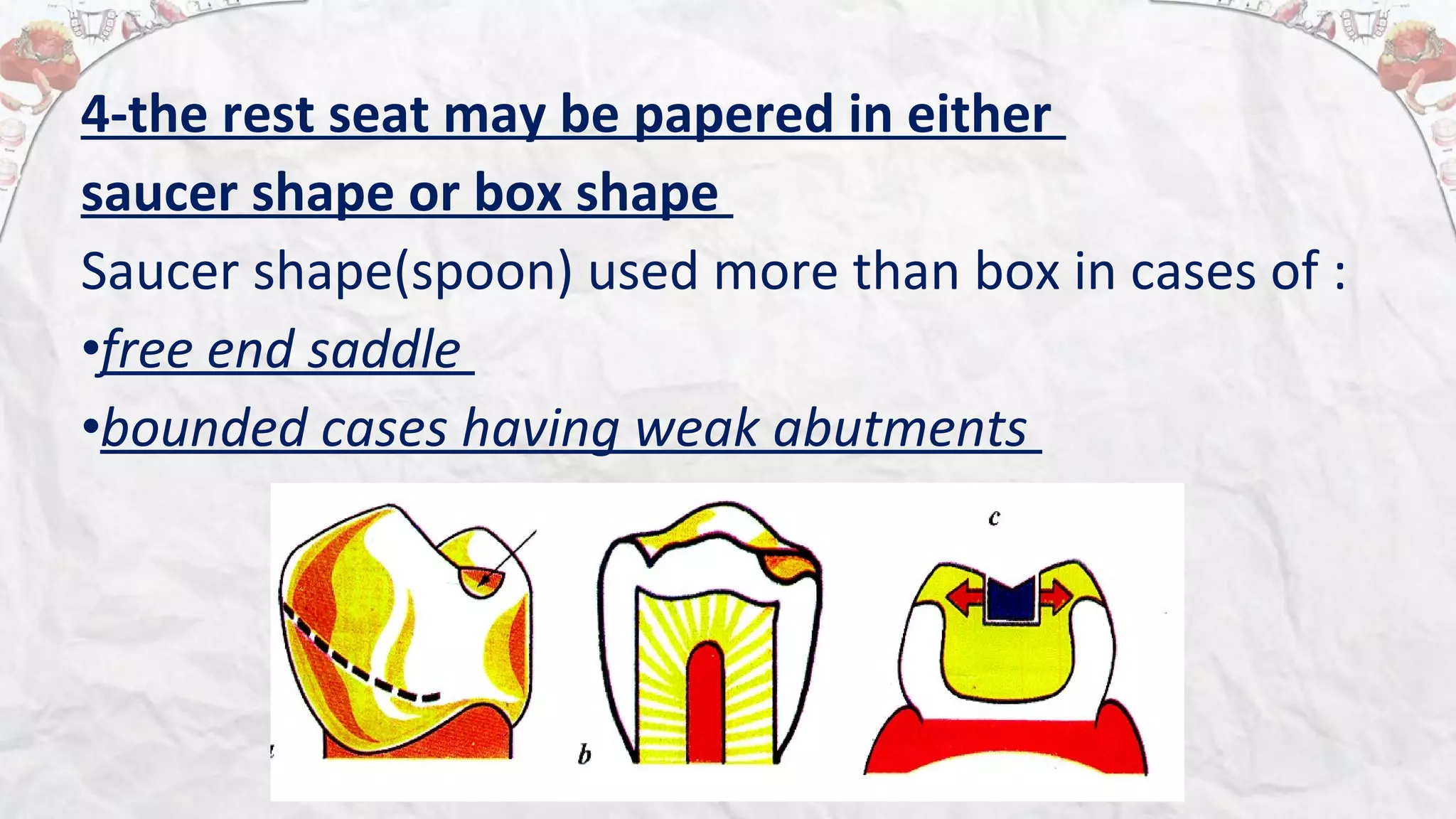 Rest and Rest Seat preparation..removable partial denture | PPT