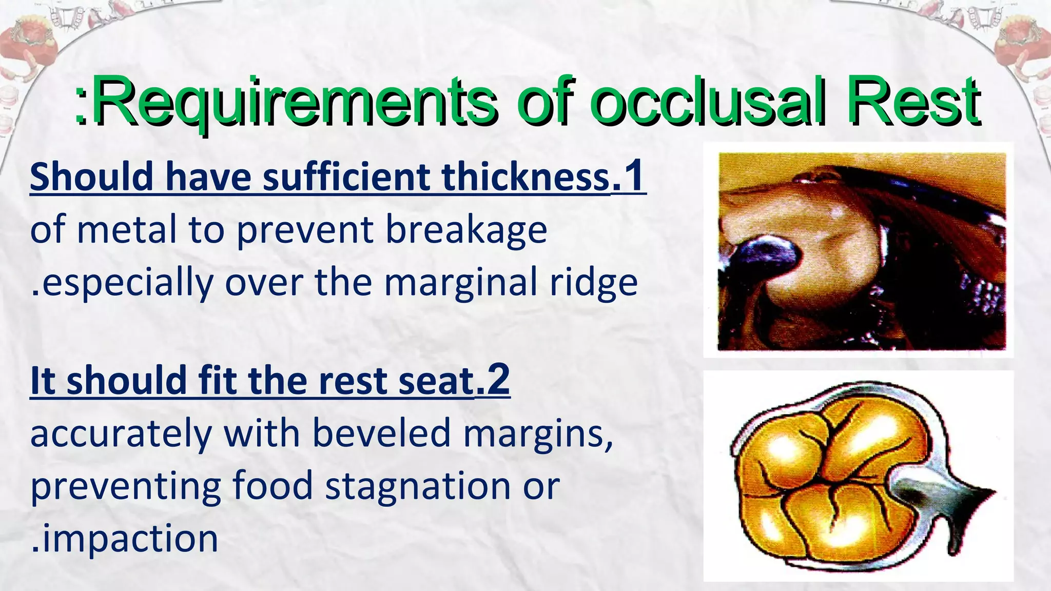 Rest and Rest Seat preparation..removable partial denture | PPT