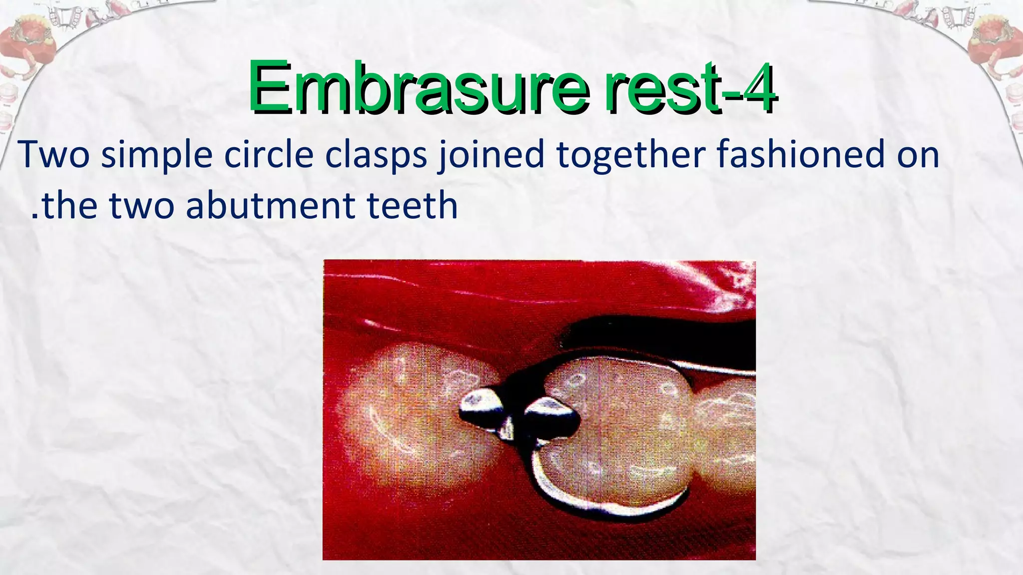 Rest and Rest Seat preparation..removable partial denture | PPT