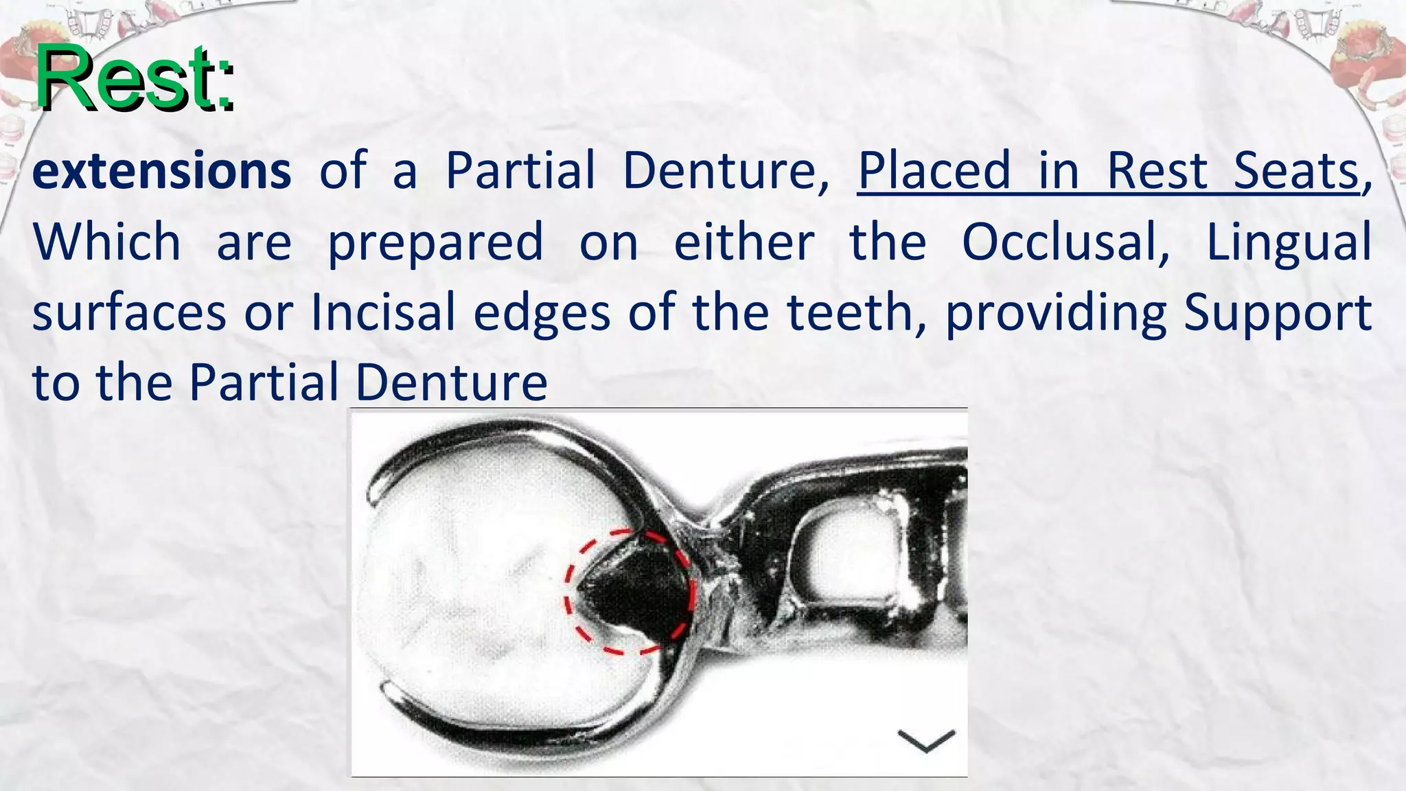 Rest and Rest Seat preparation..removable partial denture | PPT