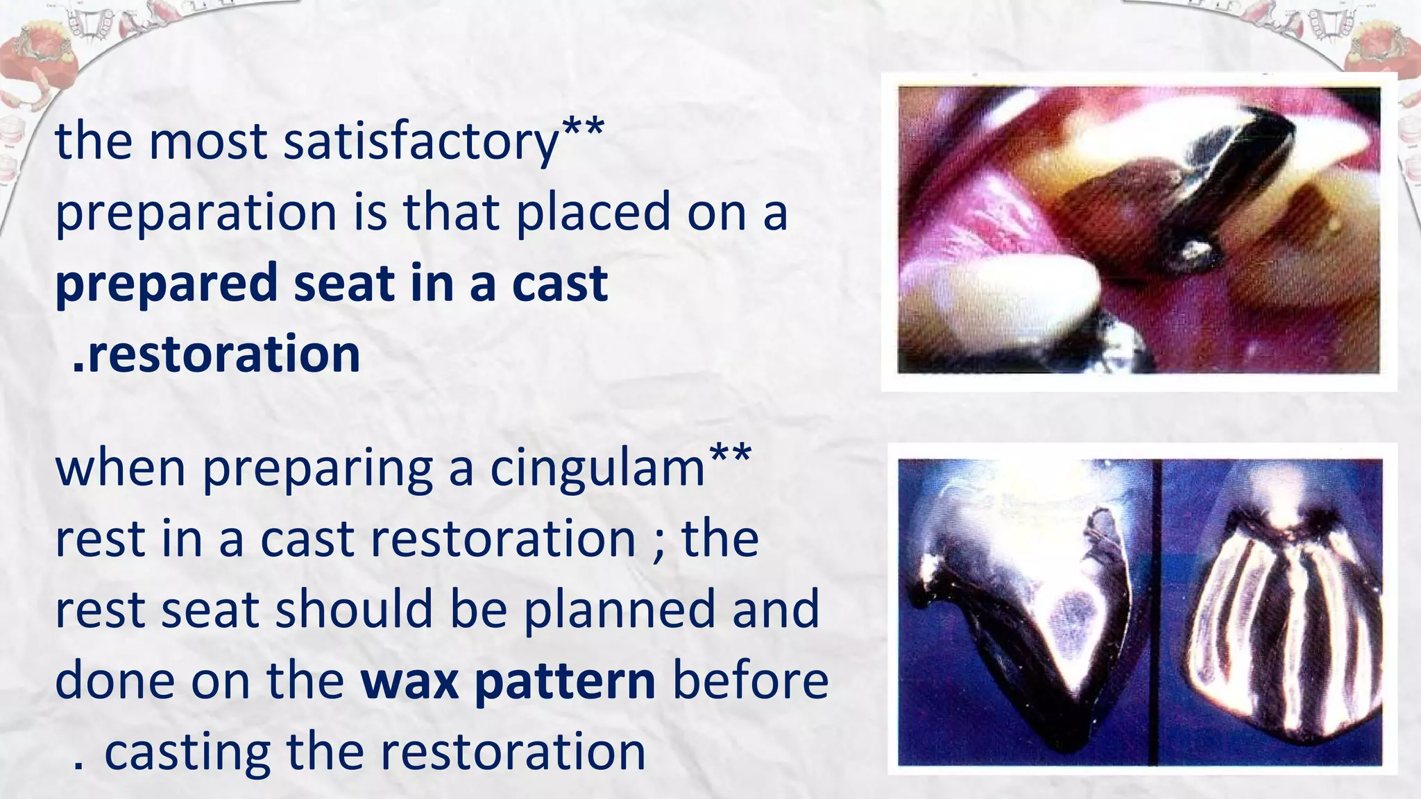 Rest and Rest Seat preparation..removable partial denture | PPT