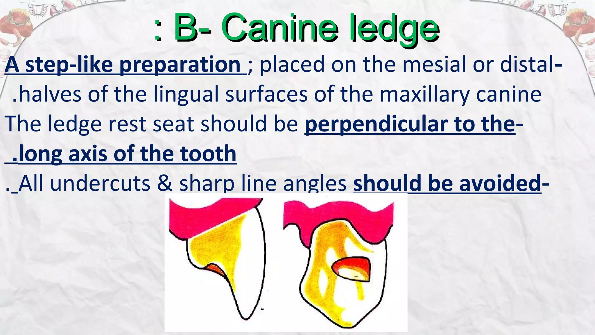 Rest and Rest Seat preparation..removable partial denture | PPT
