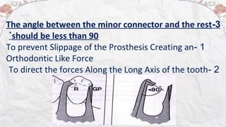 Rest and Rest Seat preparation..removable partial denture | PPT