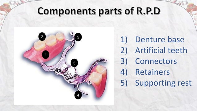 Rest and Rest Seat preparation..removable partial denture | PPT ...