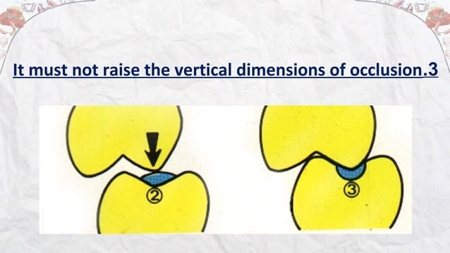 Rest and Rest Seat preparation..removable partial denture | PPT ...