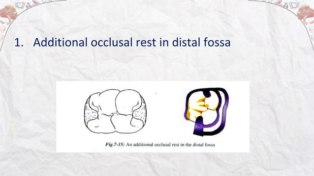 Rest and Rest Seat preparation..removable partial denture | PPT ...