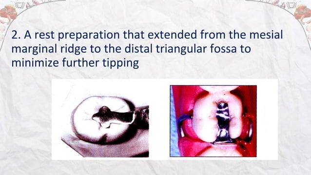 Rest and Rest Seat preparation..removable partial denture | PPT ...