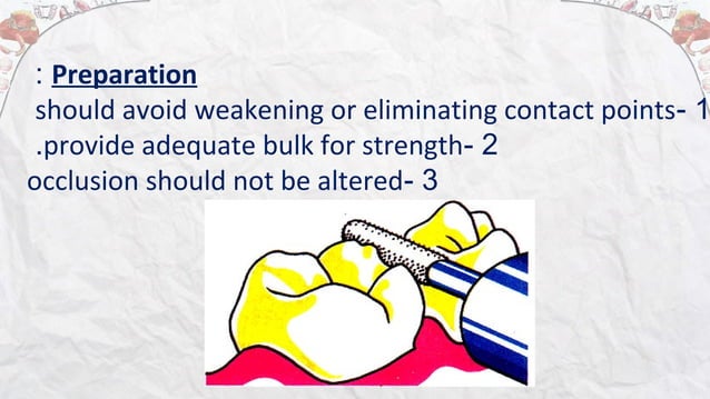 Rest and Rest Seat preparation..removable partial denture | PPT ...