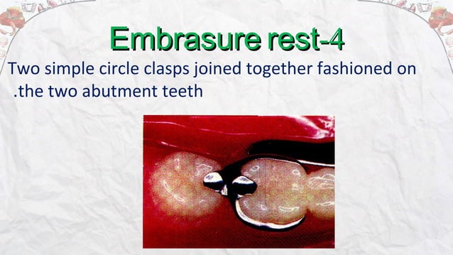 Rest and Rest Seat preparation..removable partial denture | PPT ...