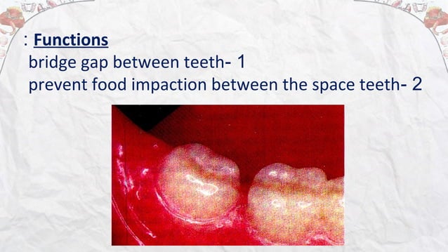 Rest and Rest Seat preparation..removable partial denture | PPT ...