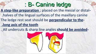 Rest and Rest Seat preparation..removable partial denture | PPT