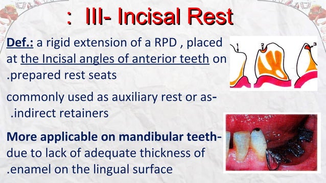 Rest and Rest Seat preparation..removable partial denture | PPT ...