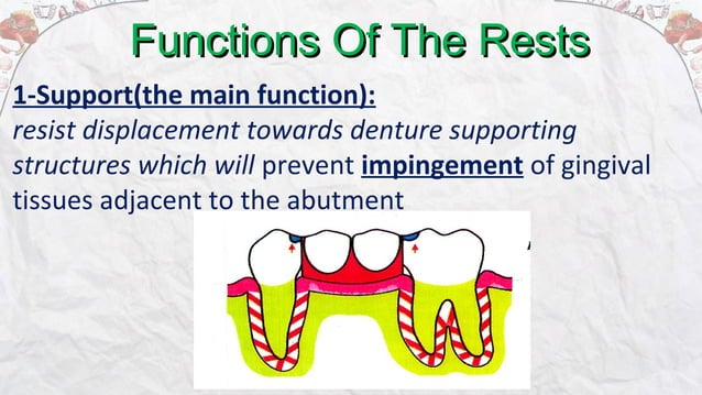 Rest and Rest Seat preparation..removable partial denture | PPT ...