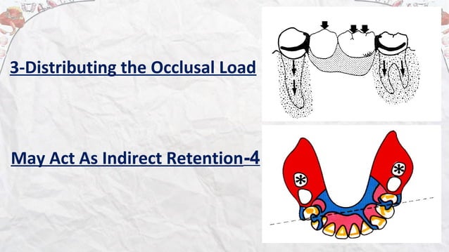 Rest and Rest Seat preparation..removable partial denture | PPT ...
