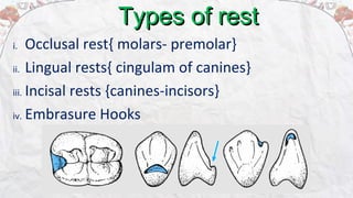 Rest and Rest Seat preparation..removable partial denture | PPT