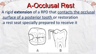 Rest and Rest Seat preparation..removable partial denture | PPT