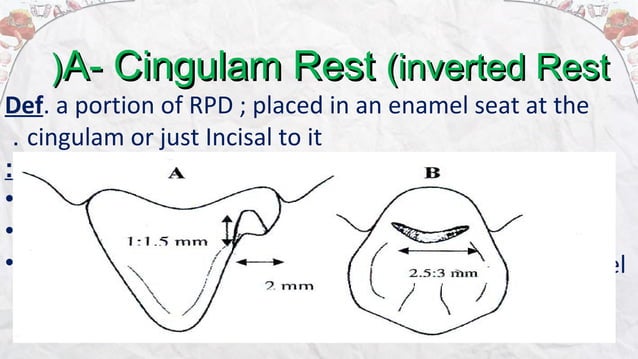 Rest and Rest Seat preparation..removable partial denture