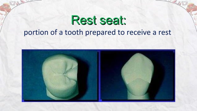 Rest and Rest Seat preparation..removable partial denture