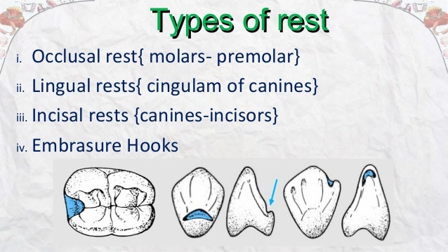 Rest and Rest Seat preparation..removable partial denture