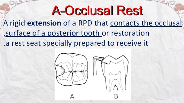 Rest and Rest Seat preparation..removable partial denture
