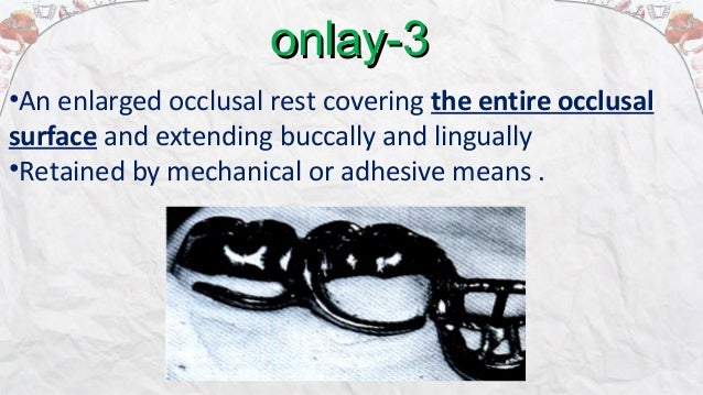 Rest and Rest Seat preparation..removable partial denture