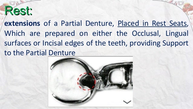 Rest and Rest Seat preparation..removable partial denture