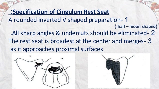 Rest and Rest Seat preparation..removable partial denture