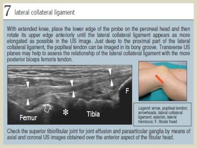 Presentation1.pptx, ultrasound examination of the knee joint.
