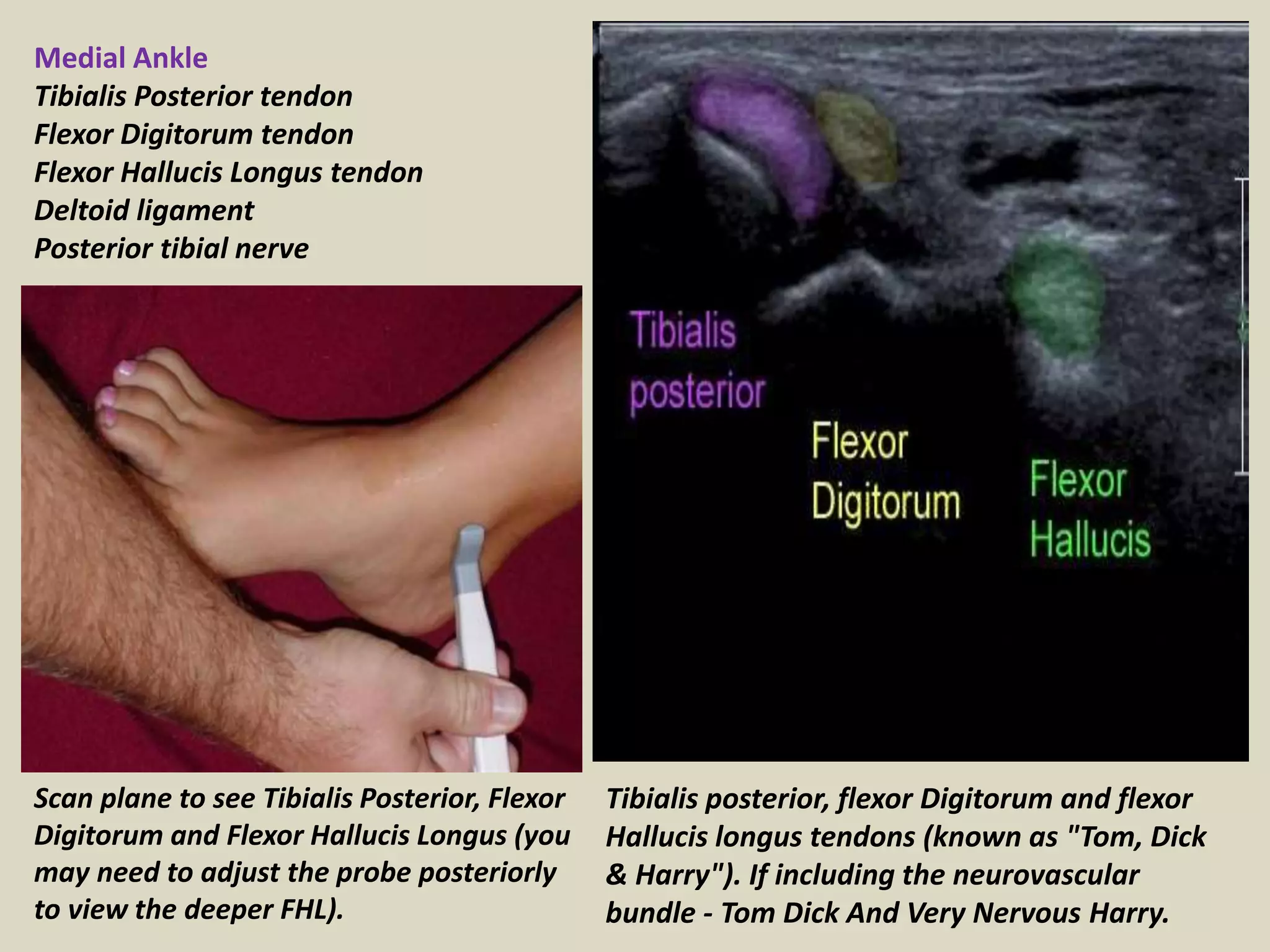 Presentation1.pptx. ultrasound examination of the ankle joint. | PPTX