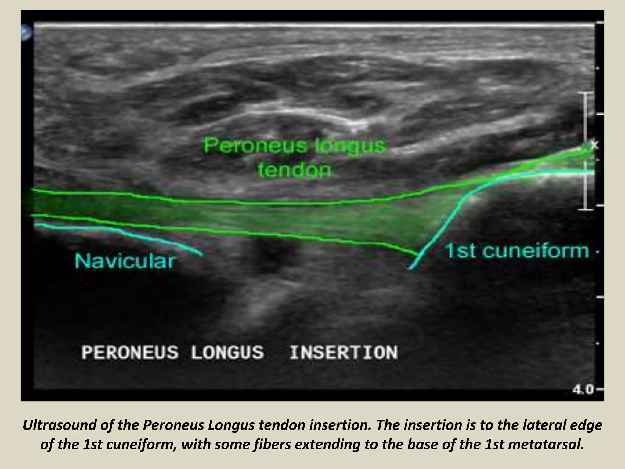 Presentation1.pptx. ultrasound examination of the ankle joint. | PPTX