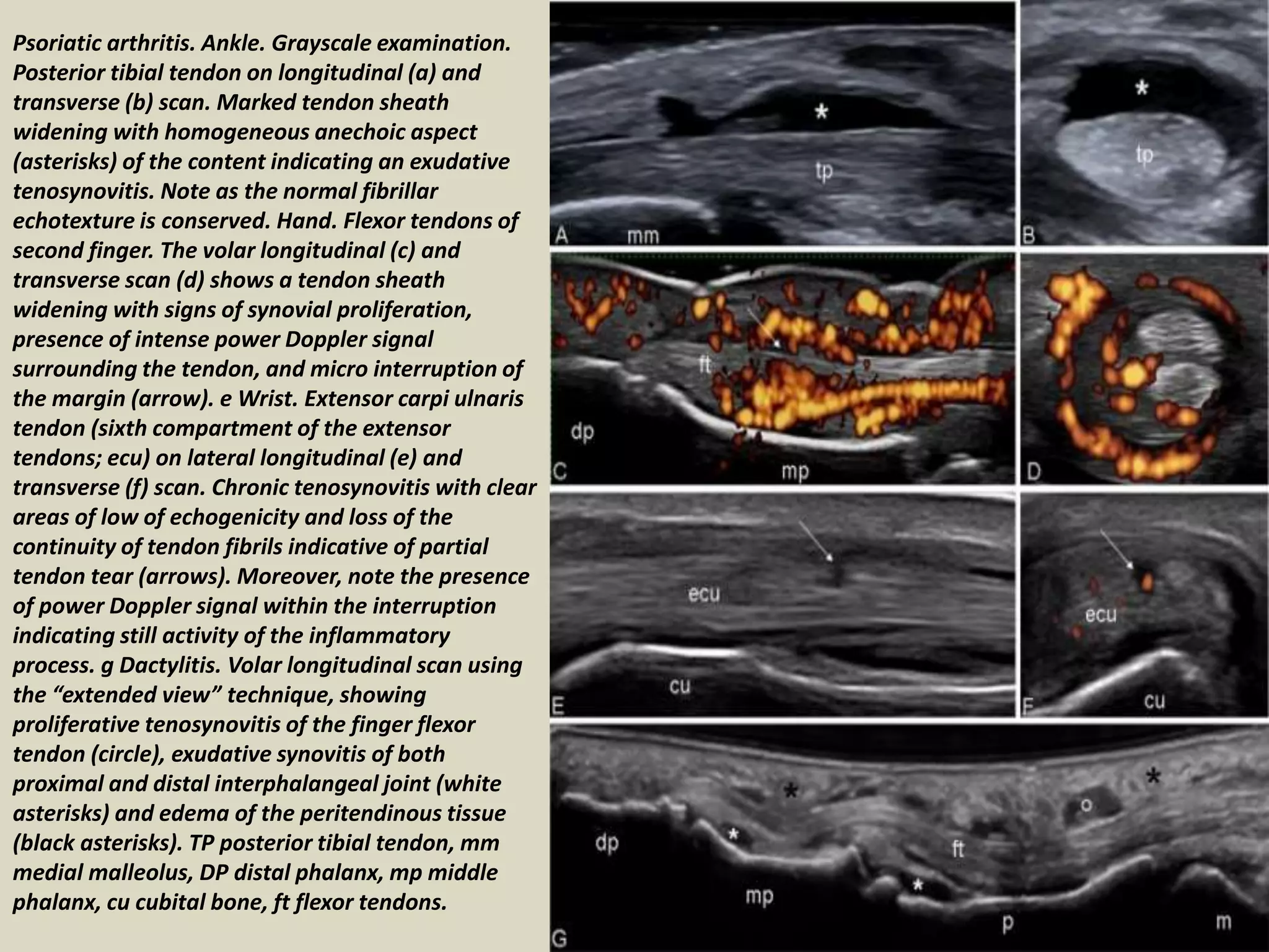 Presentation1.pptx. ultrasound examination of the ankle joint. | PPTX