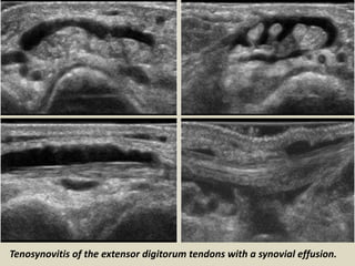 Presentation1.pptx. ultrasound examination of the ankle joint. | PPTX